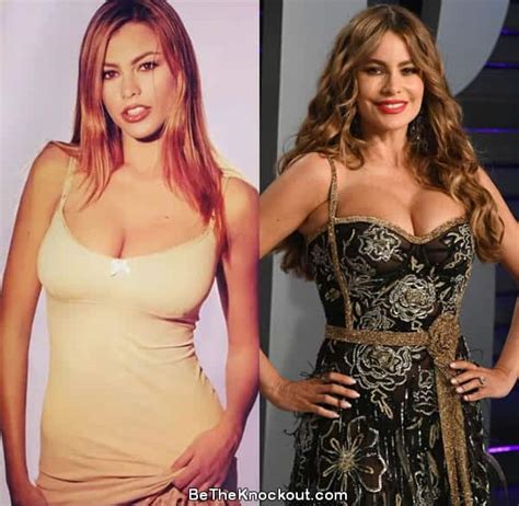 Sofia Vergara Plastic Surgery Comparison Photos