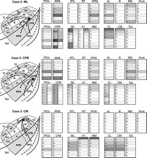 Summary Of Areal And Laminar Projection Profiles From Cases 2 And 3 Download Scientific
