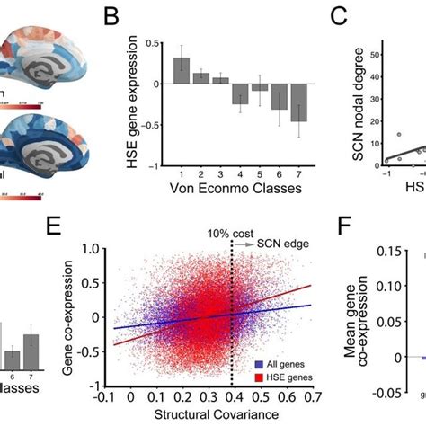 Nodal Topology And Connection Distance Of Structural Covariance Network