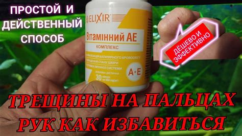 ТРЕЩИНЫ НА ПАЛЬЦАХ РУК ТРЕЩИНЫ НА РУКАХ КАК ЛЕЧИТЬ ТРЕЩИНЫ НА ПЯТКАХ ...