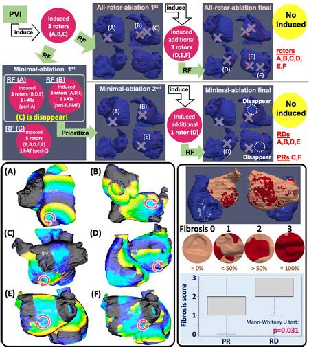 Abstract 12792 Reentrant Drivers Are Distinguished From Passive Rotors By Sequential Computer