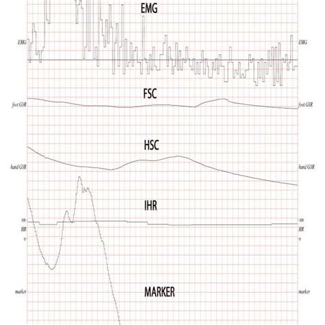 Pdf A Novel Method Of Stress Detection Using Physiological Measurements Of Automobile Drivers