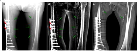 X Ray Attenuation Window Level 2 45 Window Width 1 9 A Dark Field Download Scientific