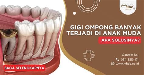 Mengenali Gejala Radang Tenggorokan Kapan Harus Ke Dokter