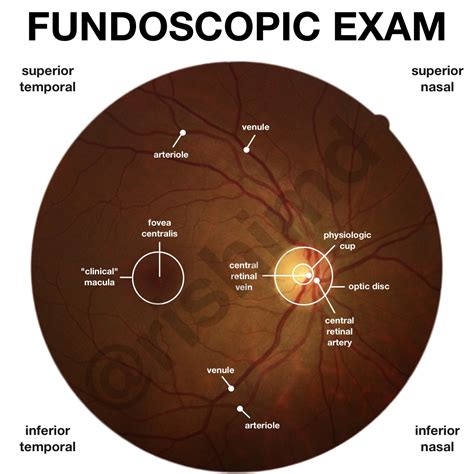 Fundoscopic Exam Abnormal Findings