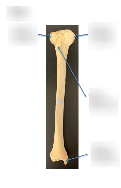 Lab 6 Tibia Anterior View Diagram Quizlet