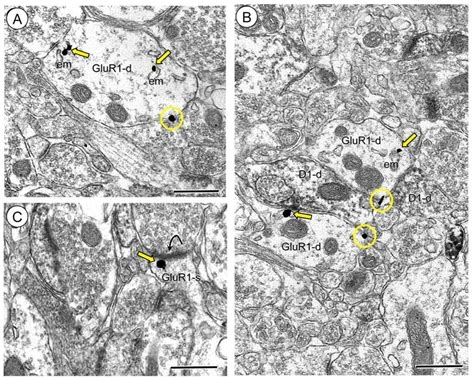 Chronic Administration Of Morphine Is Associated With A Decrease In
