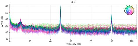 Electroencephalography Based Depression Detection Using Multiple Machine Learning Techniques
