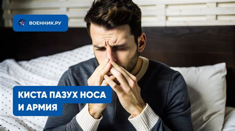 Киста пазух носа и армия перспективы освобождения