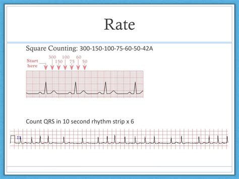 Ppt Ecg For Interns Powerpoint Presentation Free Download Id3038471