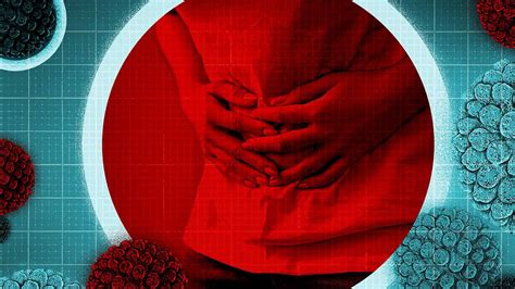 Beat The Super Norovirus Thats Sweeping Britain And Causing Misery