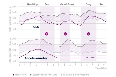 Closed Loop Stimulation Biotronik