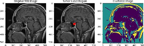 Figure 1 From Integrating Preprocessing Methods And Convolutional Neural Networks For Effective