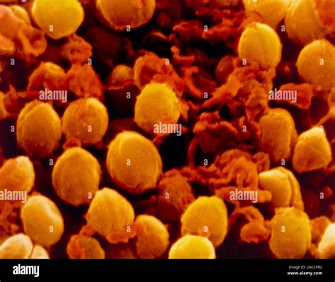 False Colour Scanning Electron Micrograph Sem Showing The Effect Of An Antibiotic On The