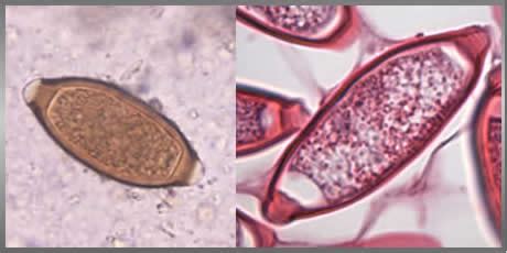 Tricuríase Ou Tricocefalíase Doenças Infoescola