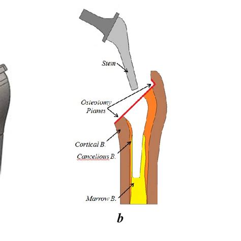A 3d Studied Stem Model B Solid Stem Parts And C Hollow Stem Parts