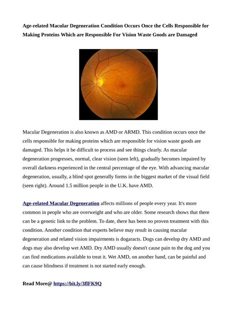 PPT Age Related Macular Degeneration Pdf PowerPoint Presentation Free Download ID 10556199