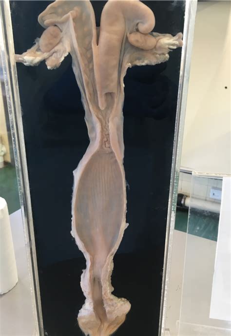 Diagram Of Female Genitalia Species Quizlet