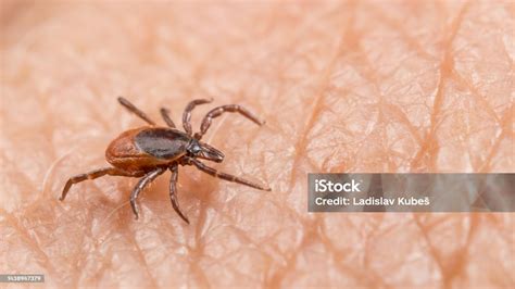 인간의 피부 배경에 있는 암컷 사슴 진드기 기생충의 근접 촬영 익소데스 리시누스 딱정벌레에 대한 스톡 사진 및 기타 이미지