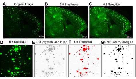 Full Versus Sub Regional Quantification Of Amyloid Beta Load On Mouse