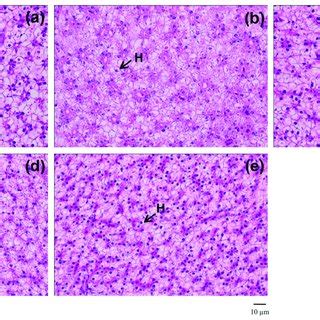 The Microanatomy In Longitudinal Section Of Liver For Sex Reversed Red Download Scientific