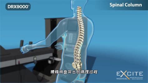 腰椎间盘突出的病因能做牵引治疗吗3D演示 科普新知自习室 健康视频 搜狐视频
