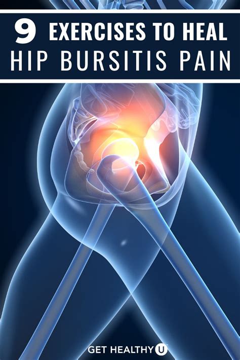 Hip Bursitis