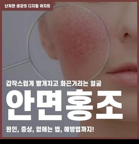 겨울철 붉어지는 얼굴 안면홍조 원인 증상 없애는 법 예방법 난처한 생강의 디지털 아지트