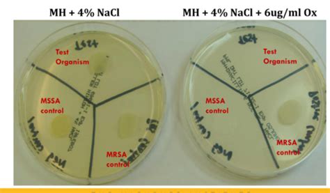 Oxacillin And Vancomycin Screen And Limitations Flashcards Quizlet