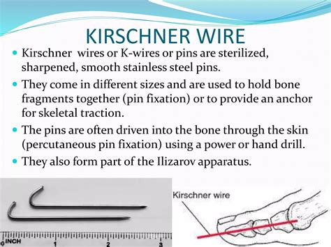 External Internal Fixation Dcp And Cast Syndrome Pptx