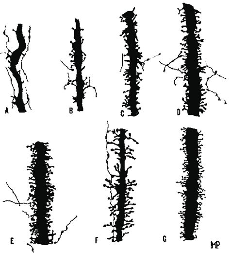 Dendritic Spine Abnormalities In Patau Syndrome And Ds Drawings Are Download Scientific