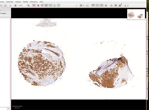 Openslide And Qupathpixelation And Background Color Abnormality In Images Read By Openslide