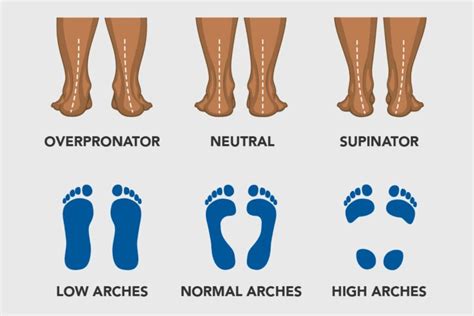 Run Faster With Gait Analysis Stay Tuned Sports Medicine