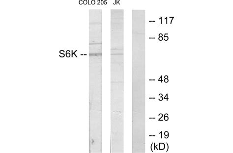 Anti S6k Antibody A96436