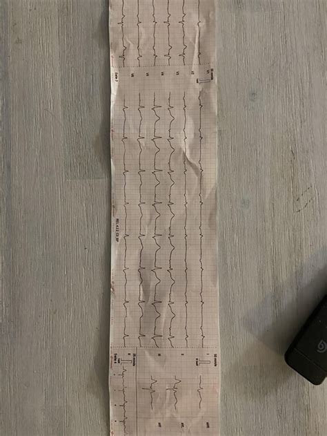 Post Rosc Ecg Rems