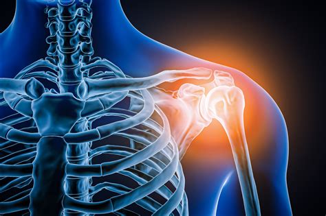 Preparing For Rotator Cuff Repair Surgery Academy Orthopedics