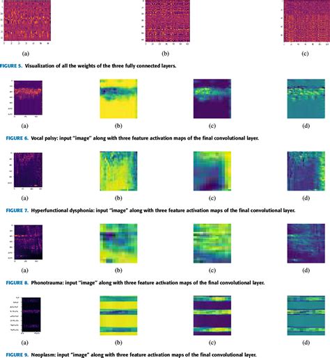Figure 5 From A Modular Deep Learning Architecture For Voice Pathology