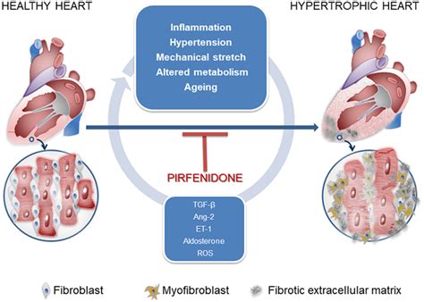 Signals Controlling Fibroblast To Myofibroblast Transdifferentiation Download Scientific