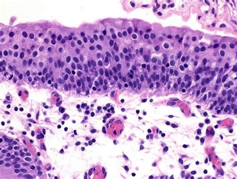 Bladder Histology Bladder Labels Histology