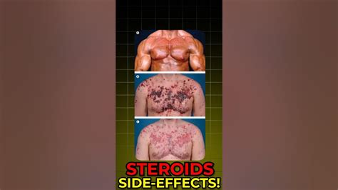 Steroids How It Builds Muscles 🤯 Gym Diet Bodybuilding Youtube