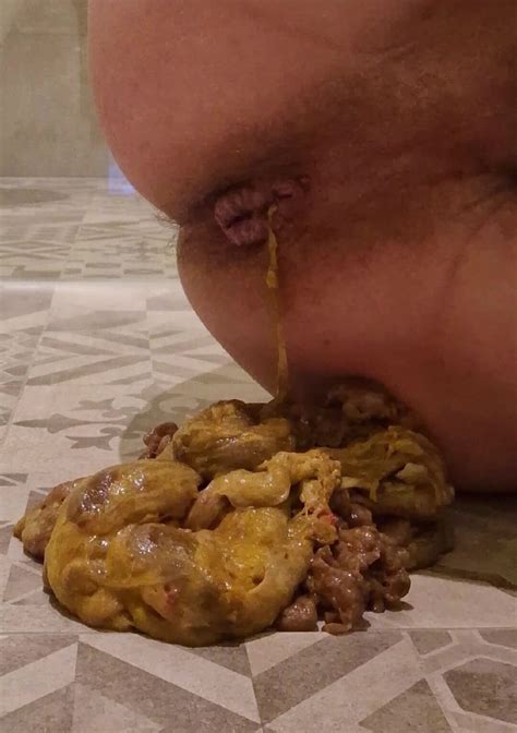 Fun With Fibre And Bisacodyl