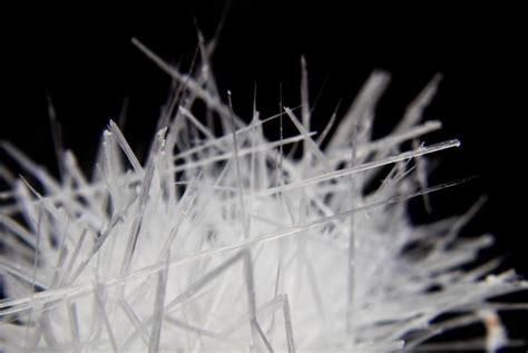 What Is Uremia Health And Detox And Vitamins