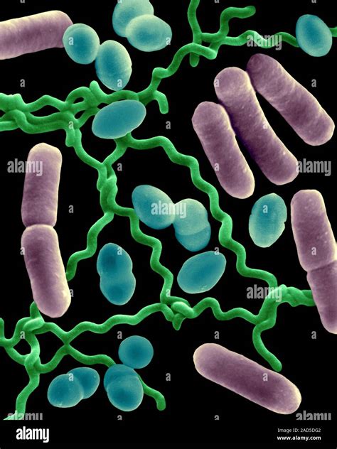 Coloured Scanning Electron Micrograph Sem Of Photocomposite Of The Three Common Types Of