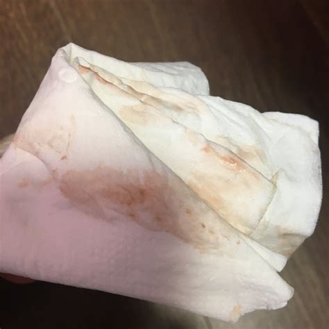 배란생리혈 착상혈 지식in