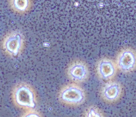 How Can I Rescue My Contaminated Thp 1 Cell Line Researchgate