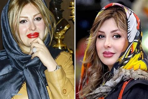 چهره متفاوت نیوشا ضیغمی قبل از عمل جراحی امکان ندارد نیوشا ضیغمی را