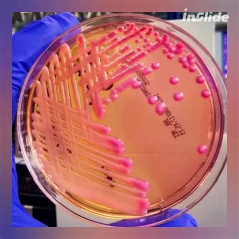 Intissar Hammedi On Linkedin Klebsiella Macconkey Cled Heckteon