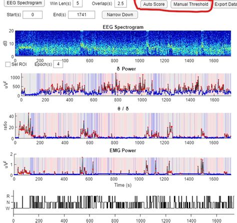 Github Li Shen Amyeegsleep Matlab Code For Sleep Cycle Analysis