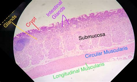 Duodenum Histology Labeled