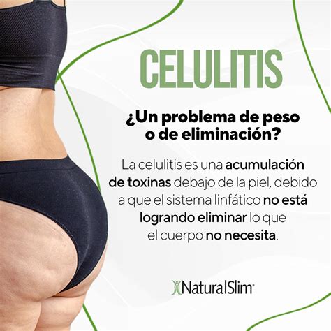 Trucos Para Eliminar Y Evitar La Celulitis Naturalslim Usa